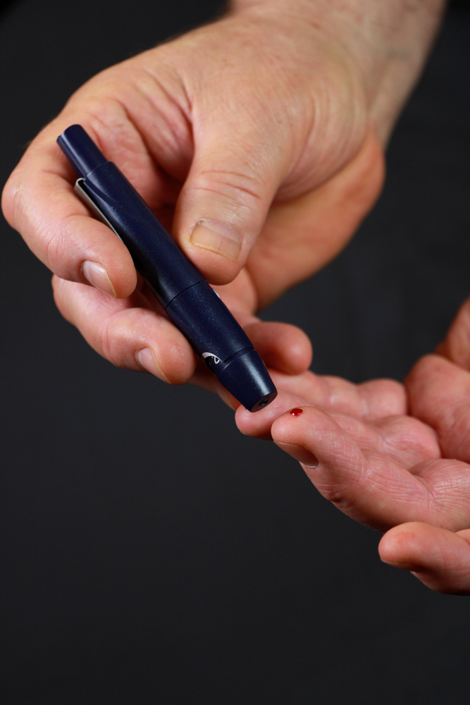 ELISPOT and FluoroSpot in Autoimmune Diseases | U-CyTech